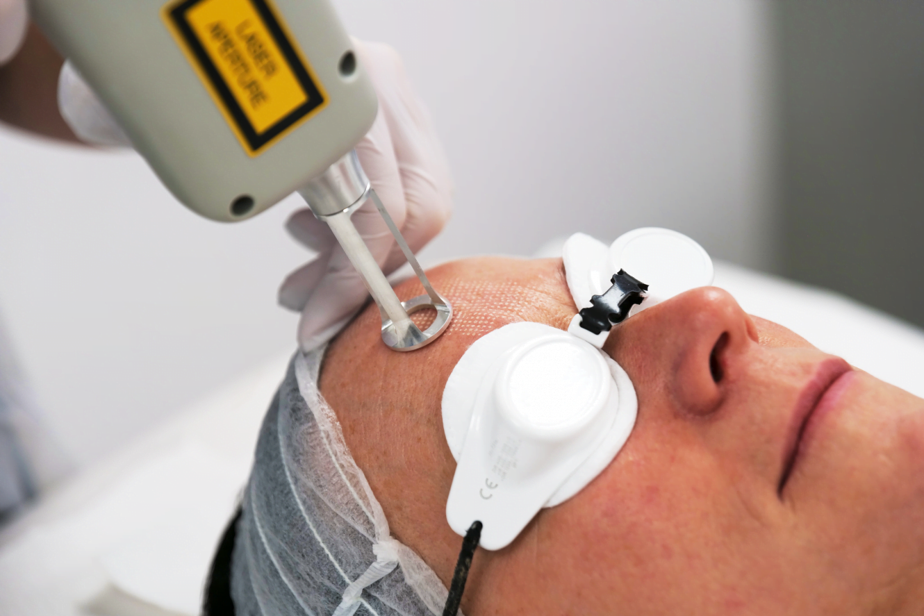 Skin Resurfacing · Skin Rejuvenation · The Lynton Clinic, Cheshire
